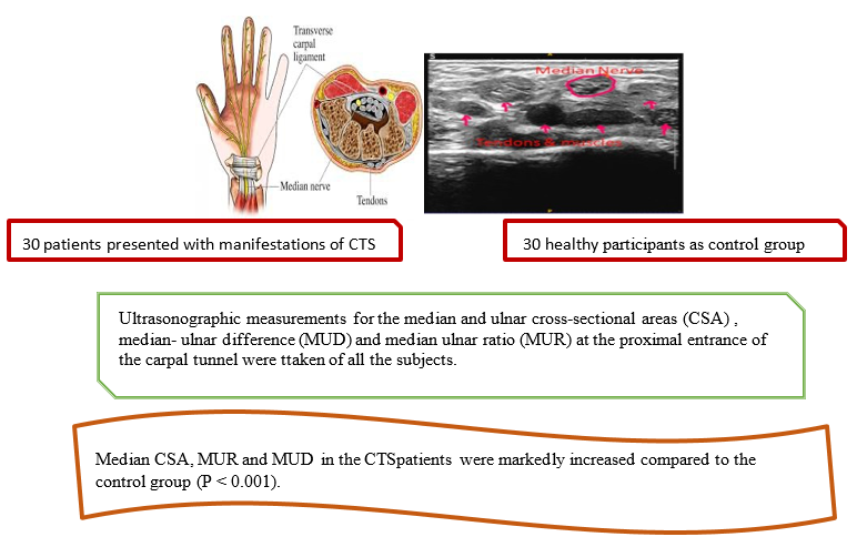 Ultrasonographic Measurement of the Median to Ulnar Nerve Cross ...